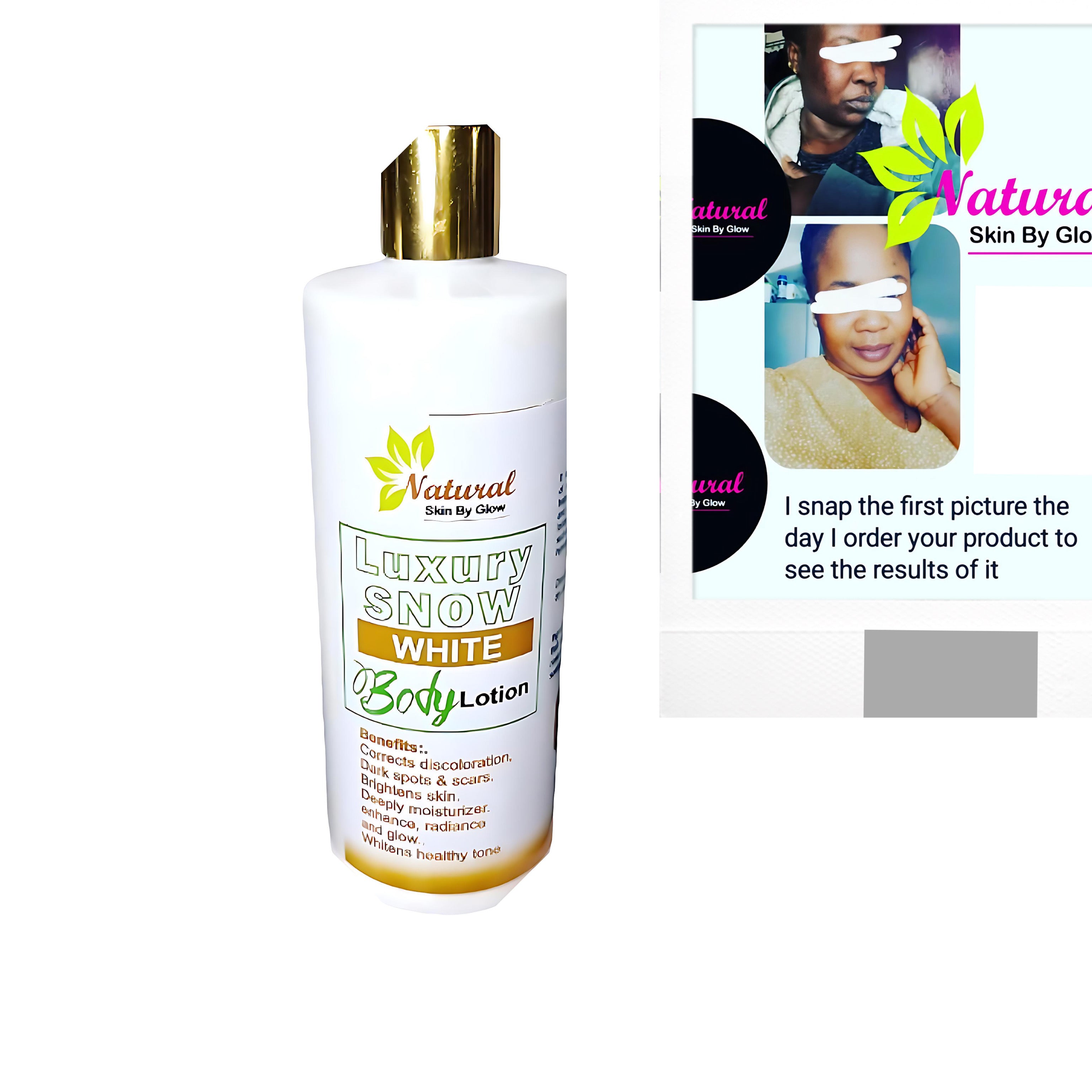 Snow White Lotion – NaturalSkinGlow